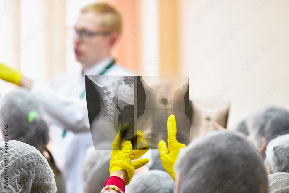 X-ray photograph in the hands. The child is holding an x-ray in his ...