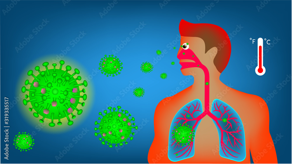 The cartoon illustration picture of the human body when catching the ...