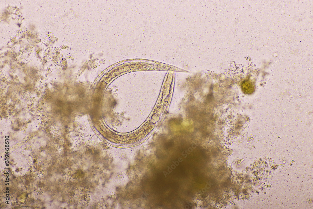 Strongyloides stercoralis or threadworm in human stool, analyze by ...