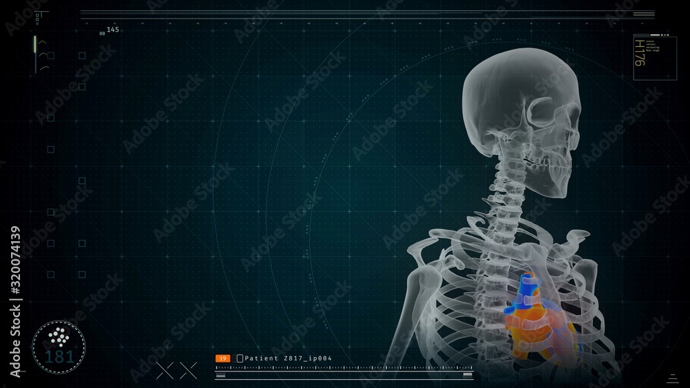Heart in skeleton, human body scan results on screen, MRI, patient's ...