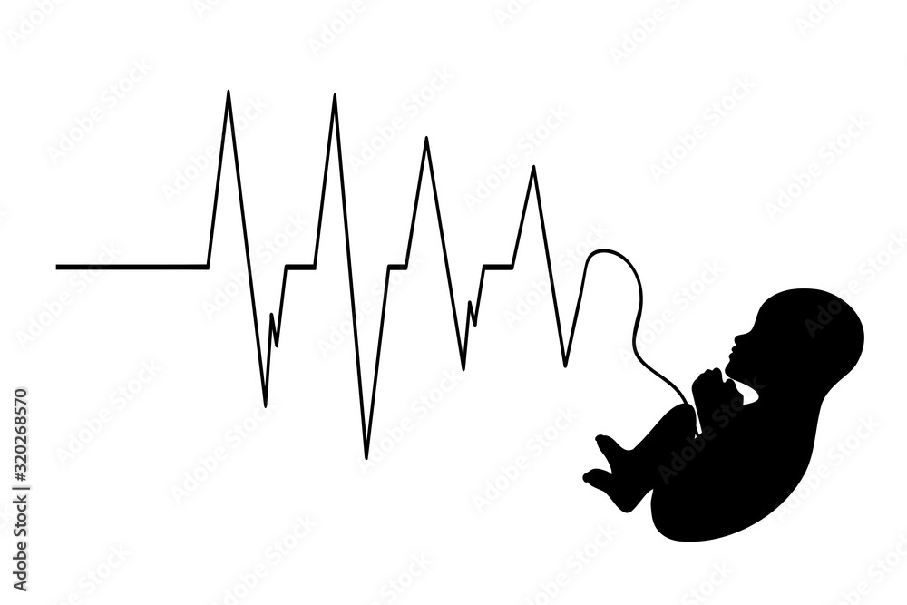 Vector illustration of fetus with heart beat on white background. Sign ...