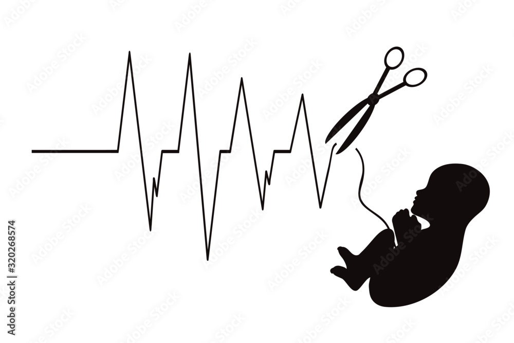 Vector illustration of abortion fetus with heart beat on white ...