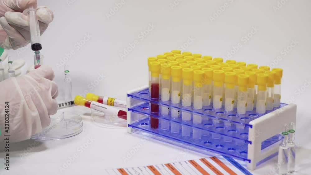 Coronavirus COVID-19 2019-nCoV world outbreak microbiology lab tests ...