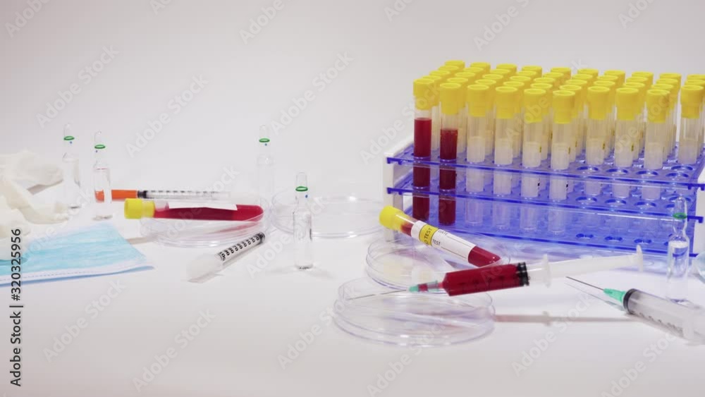 Microbiology lab medical biological virus concept. Clinical tests with ...