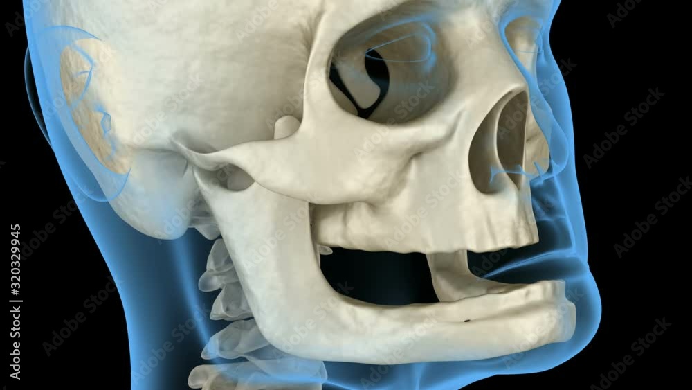 Mandibular Jaw, bone recession after losing teeth. Medically accurate ...