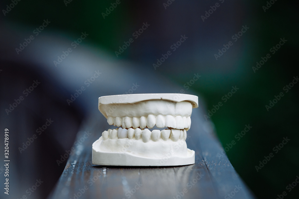 Plastic jaw model for stomatology and maxillofacial surgery. Stock ...