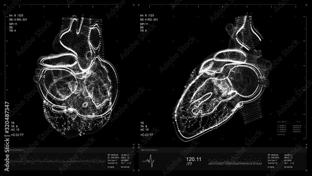 Heart scan screen animation. The device scans and displays vital signs ...