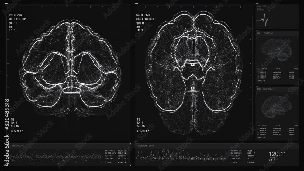 Brain scan visualization footage. The device scans and displays vital ...