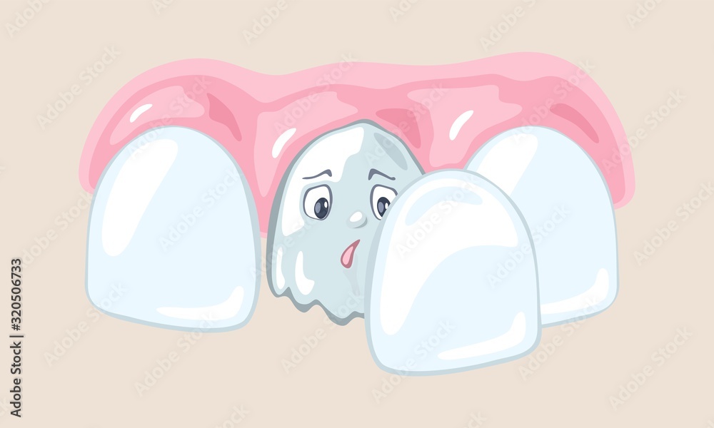 Bad tooth is among healthy teeth. Installation of veneer, implant ...