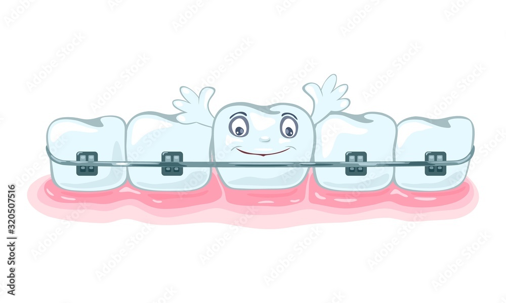 Using of metallic dental braces, orthodontic brackets to correct ...