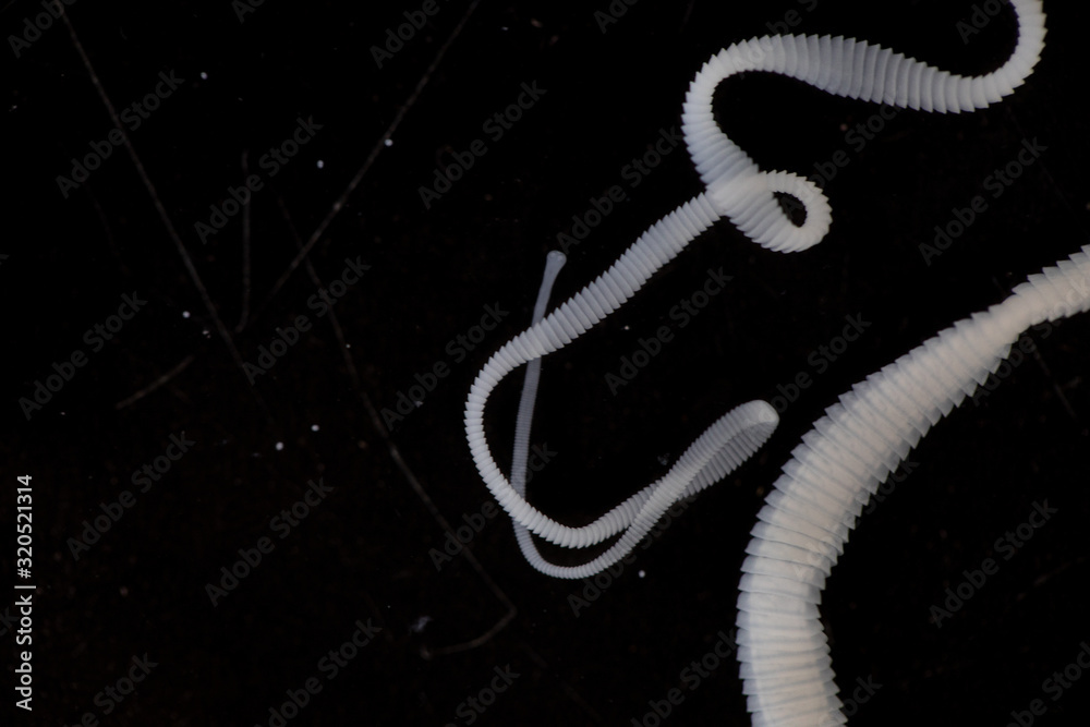 The study of Tapeworm infection is caused by ingesting food or water ...