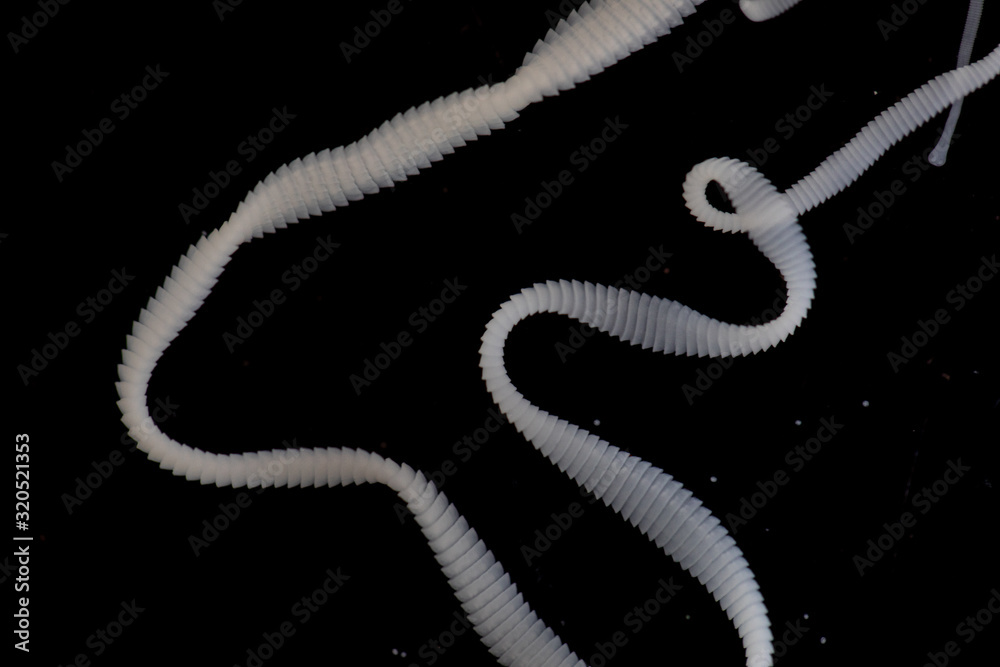 The study of Tapeworm infection is caused by ingesting food or water ...