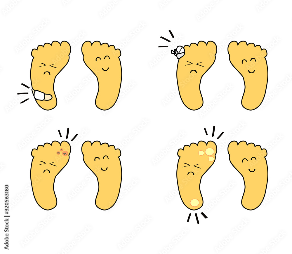 Human foot and injury on a white background. Cartoon. Vector ...