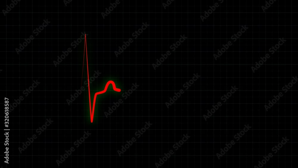 Vidéo Stock Heartbeat line. Seamlessly loop animation, EKG ECG screen ...