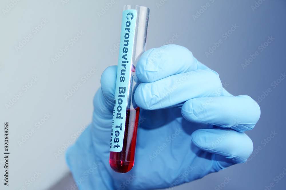 medical laboratory test tube with blood in the hand of a virologist ...