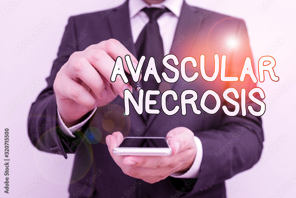 Handwriting text Avascular Necrosis. Conceptual photo death of bone ...