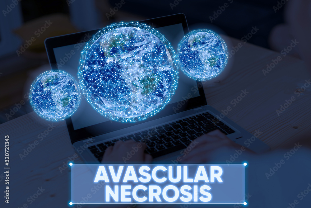 Word writing text Avascular Necrosis. Business photo showcasing death ...
