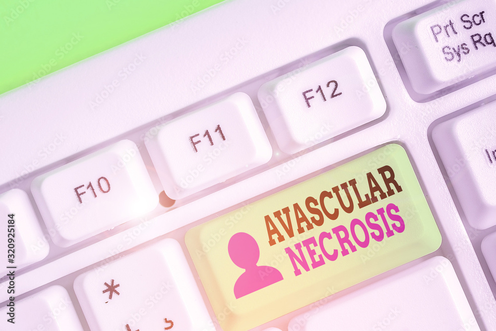 Conceptual hand writing showing Avascular Necrosis. Concept meaning ...