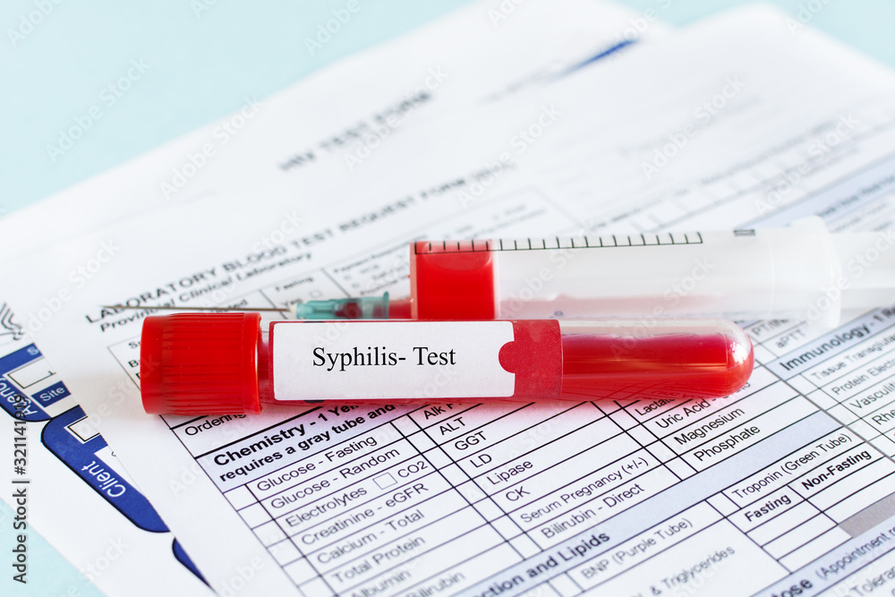 Red blood vial with blood sample for Syphilis test. Stock Photo | Adobe ...