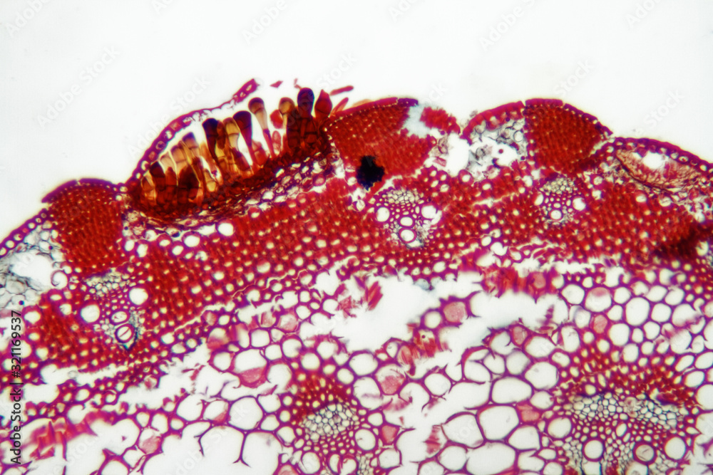 Parasitic plant fungus Puccinia showing teliospores on a microscope ...