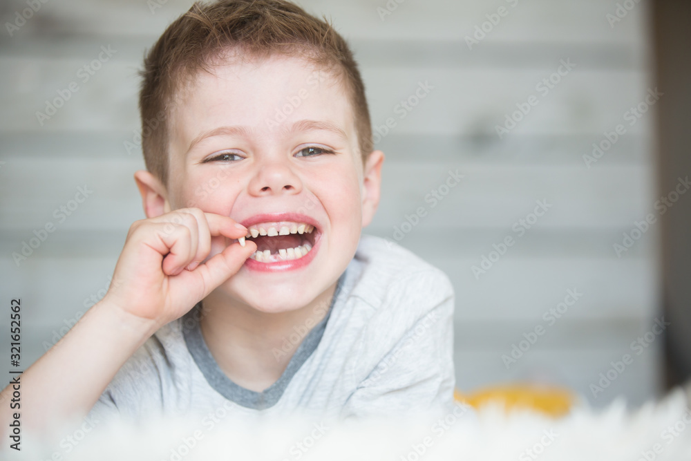 Teenager child with a tooth dropped out Stock Photo | Adobe Stock