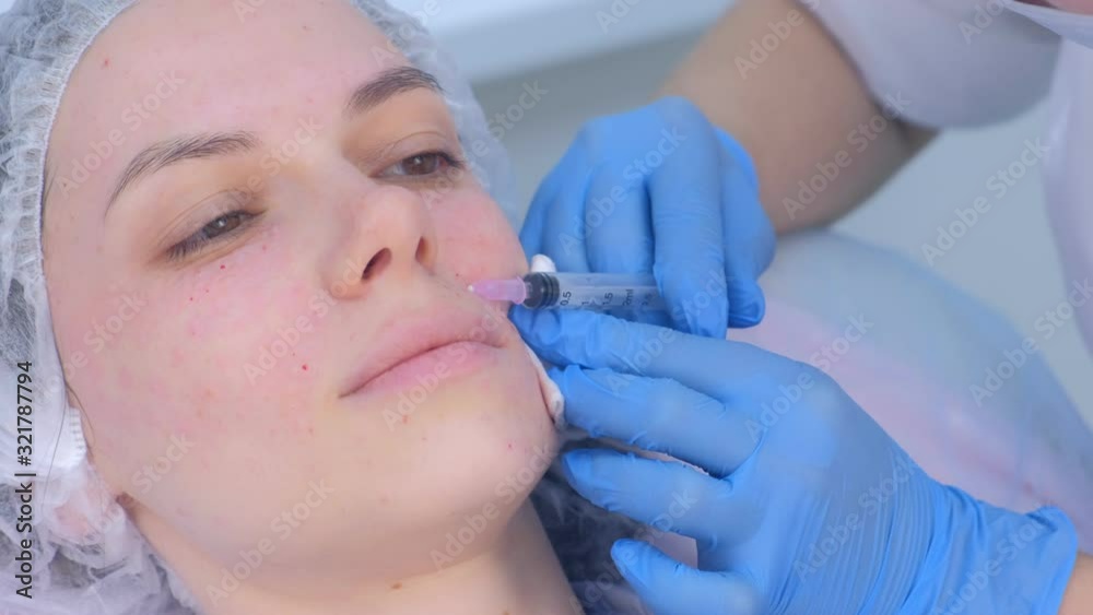 Cosmetologist doctor is making multiple injections biorevitalization ...