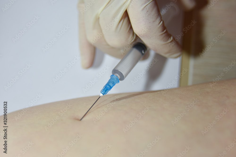 The procedure of intramuscular injection, close-up Stock Photo | Adobe ...