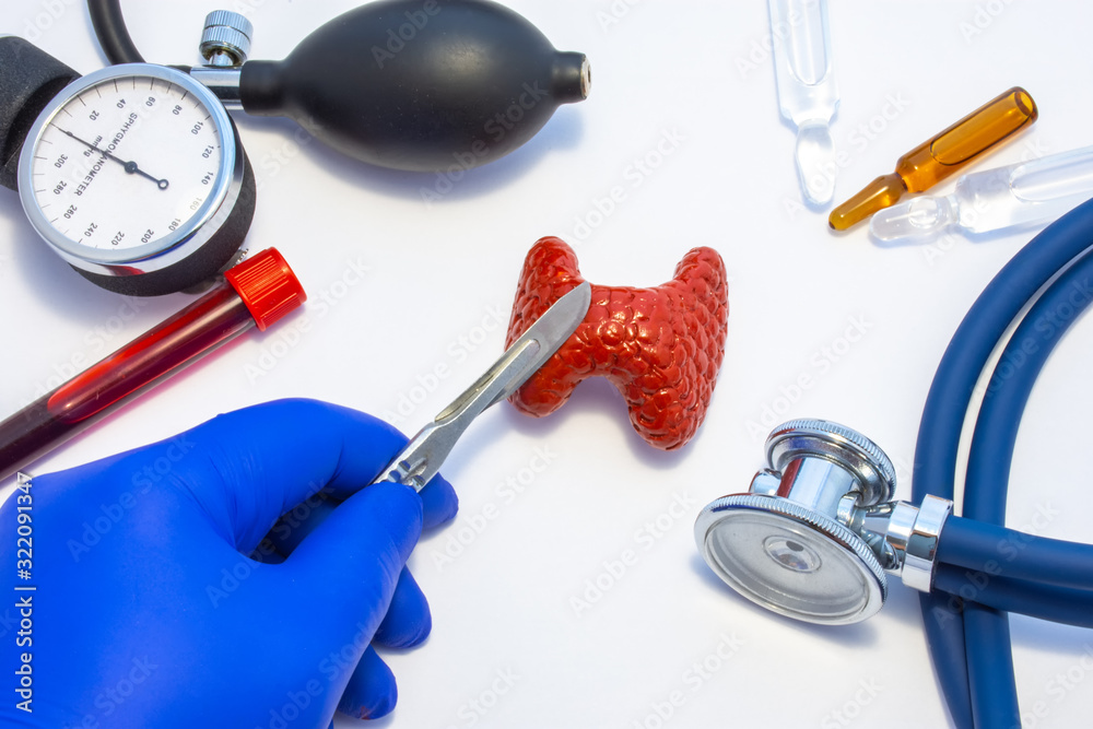 Concept photo of thyroid surgery, operation on thyroid or parathyroid ...