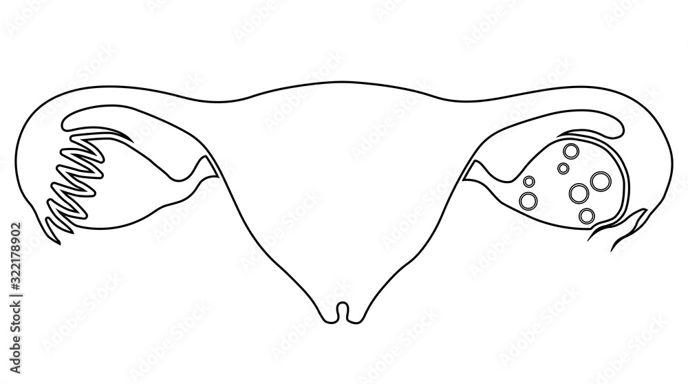 Iinternal organs of women. Uterus, ovaries and fallopian tubes. Vector ...