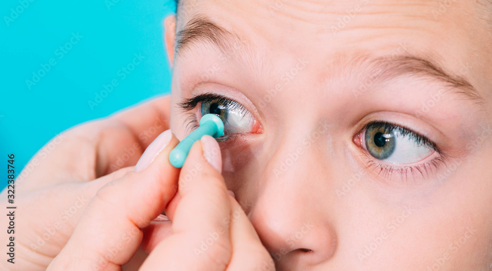 Optometrist trying on a contact lens to a teenage boy eye. Contact ...
