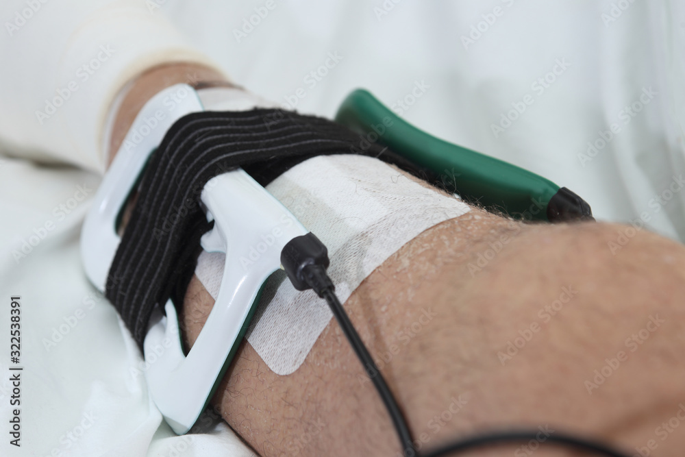 magnetotherapy - sinusoids applied on the leg fracture Stock Photo ...