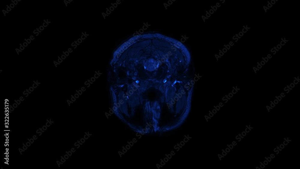 Magnetic Resonance Imaging MRI scan of a Human brain, ultra hd 4k, time ...