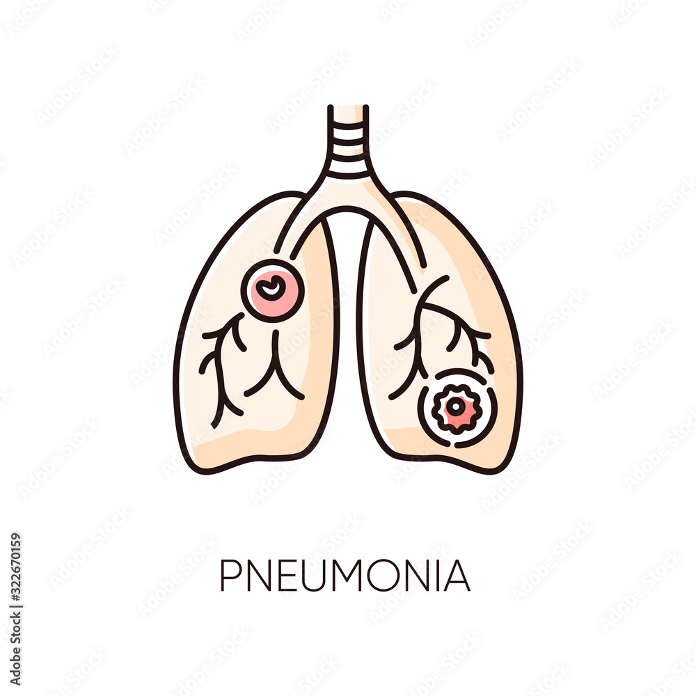Pneumonia RGB color icon. Dangerous respiratory disease, pulmonary ...