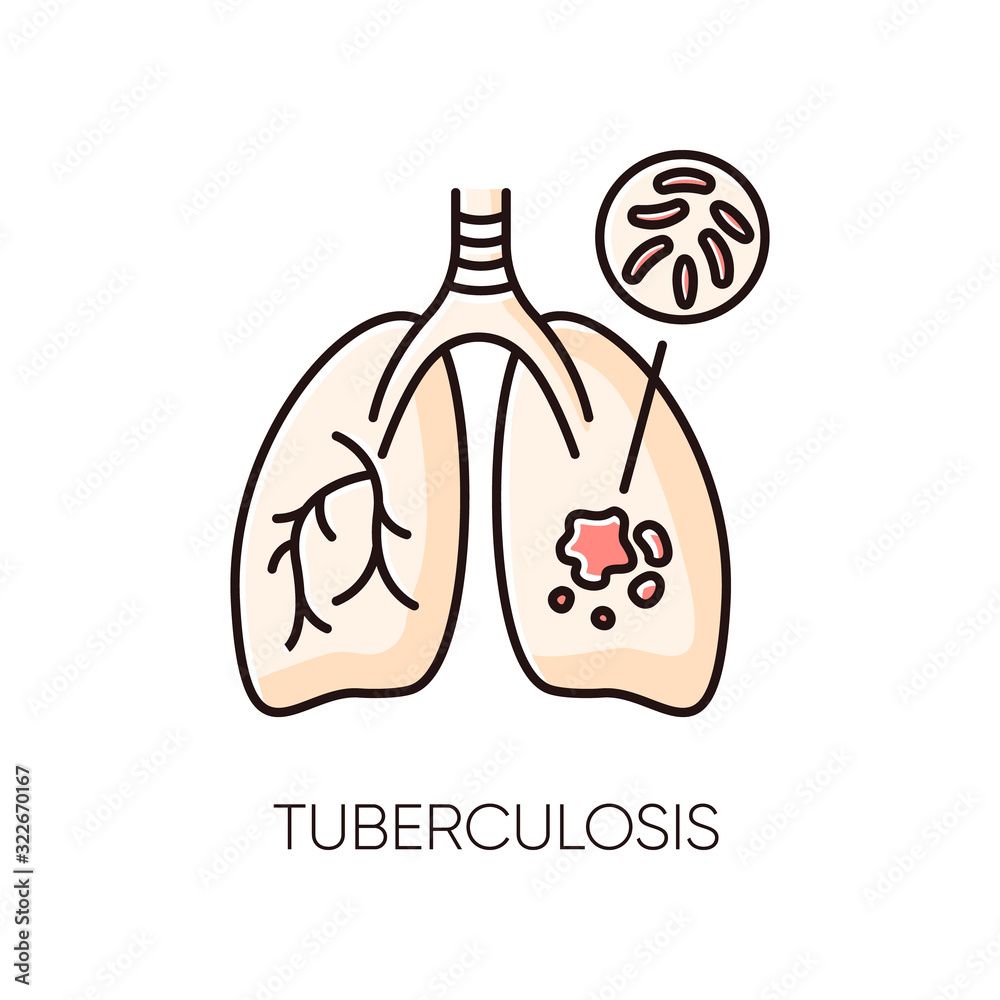 Tuberculosis RGB color icon. Contagious respiratory illness, dangerous ...