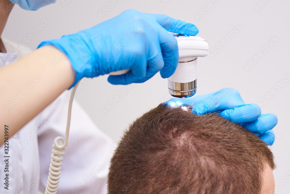 Microscopic examination of the hair and skin of the scalp. Stock Photo ...
