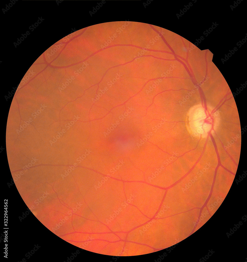View inside human eye showing retina, optic nerve and macula. Health ...