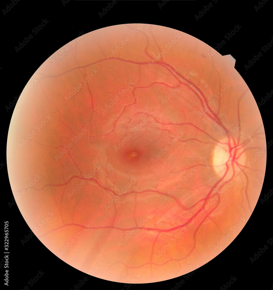 Human eye anatomy taking images with Mydriatic Retinal cameras ...
