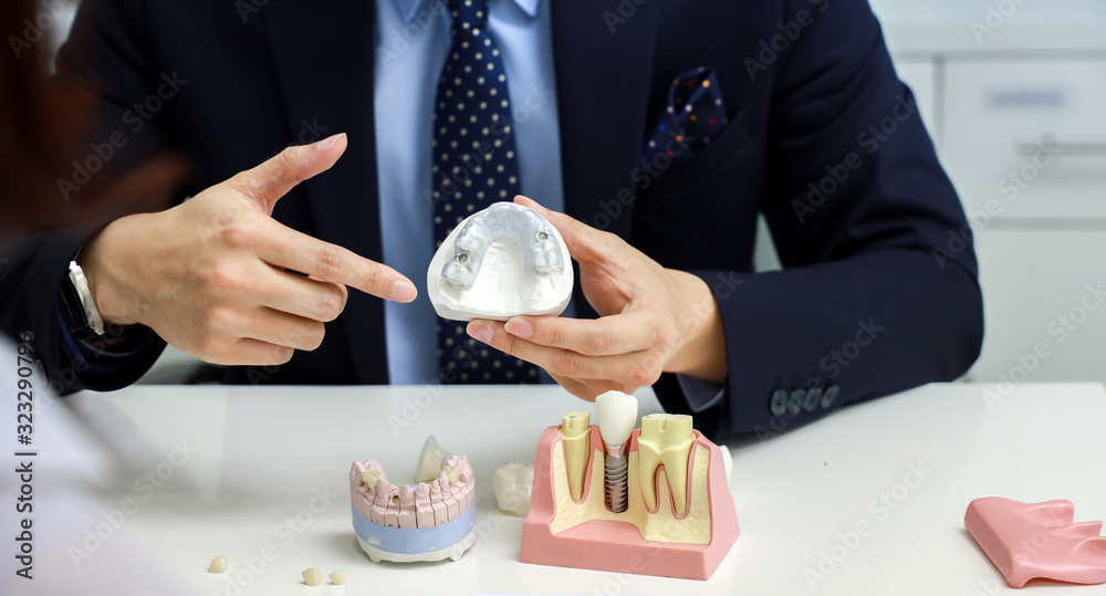 men explain take tooth implant false tooth and model shows that teeth ...