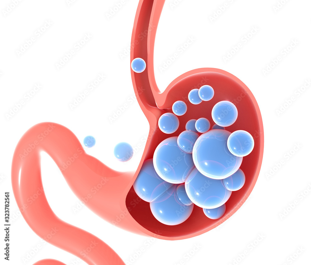 3D illustration of the human stomach with gases. Graphic representation ...