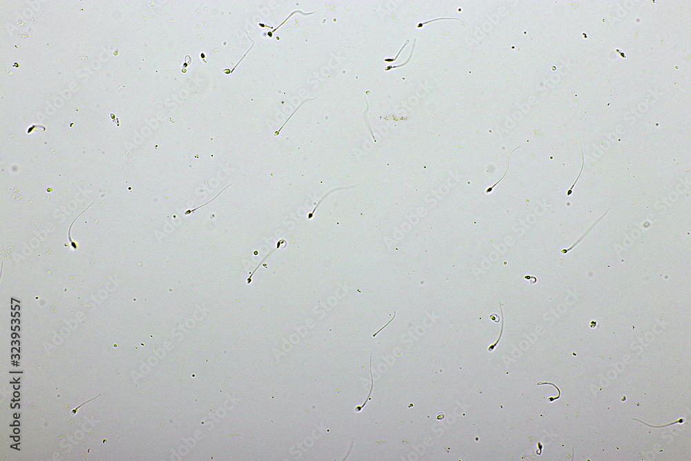 Sperm cells or spermatozoa in semen, analyze by microscope, 400x Stock ...