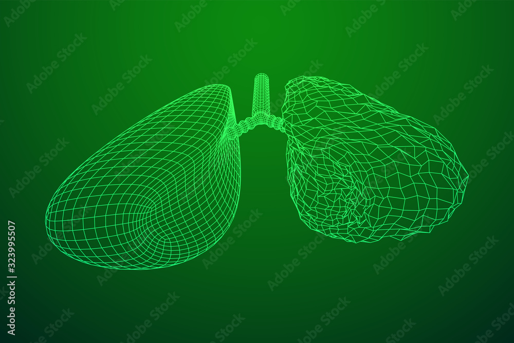 Healthy and sick lung with trachea bronchi internal organ human ...