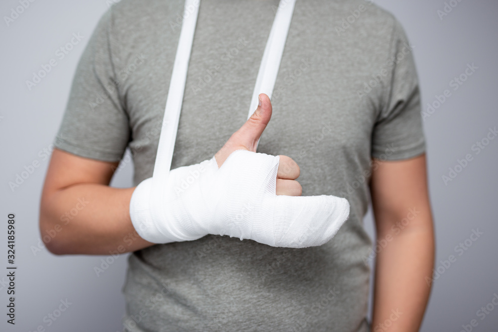 first aid concept - close up of male hand with bandage and gypsum ...