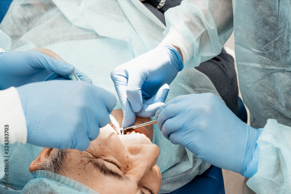 Dentists will perform an operation, implant placement. Real operation ...