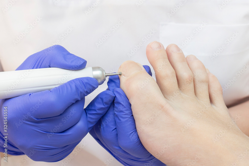 Foto de Therapeutic pedicure. Master podologist does hardware pedicure ...