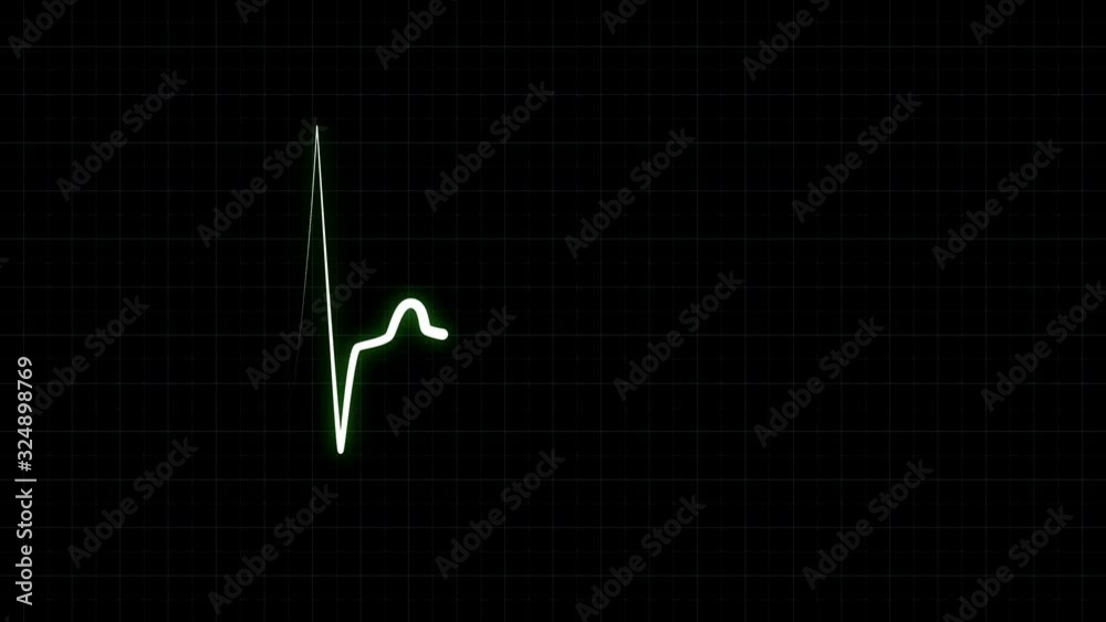Vidéo Stock Heart rate in real-time on electrocardiogram display ...