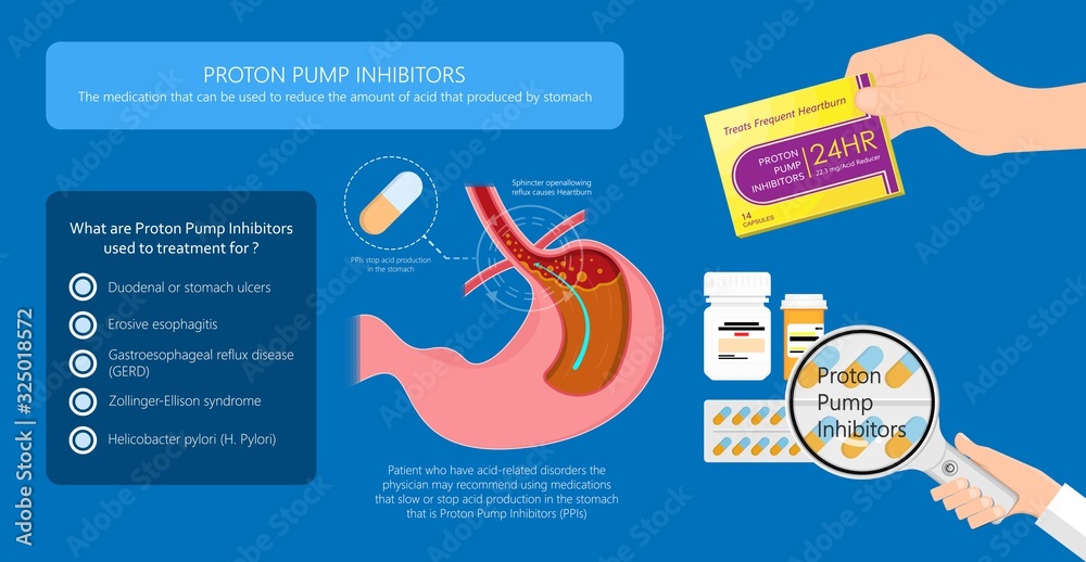 Proton pump inhibitors drugs medication for treatment stomach acid ...