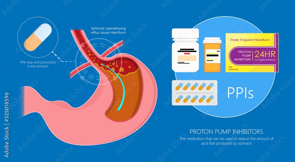 Proton pump inhibitors drugs medication for treatment stomach acid ...