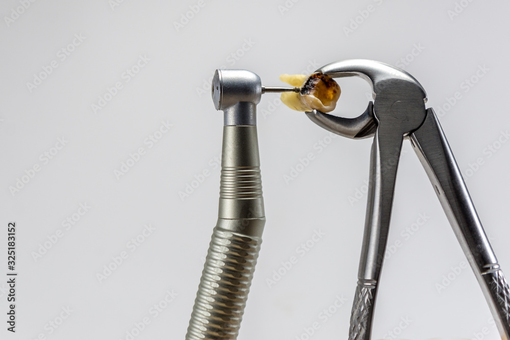 dental forceps and dental turbine tip, decide to treat or remove tooth ...