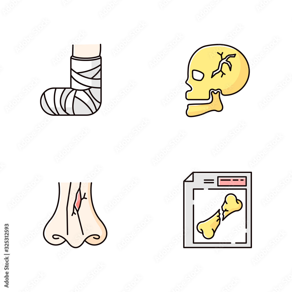 Limb and body injuries RGB color icons set. Broken foot. Cranial bone ...