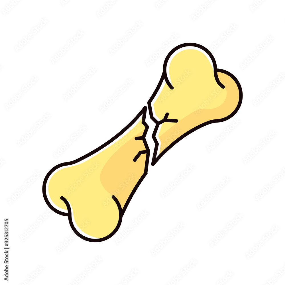 Bone fracture RGB color icon. Oblique fracture. Accident. Hurt body ...